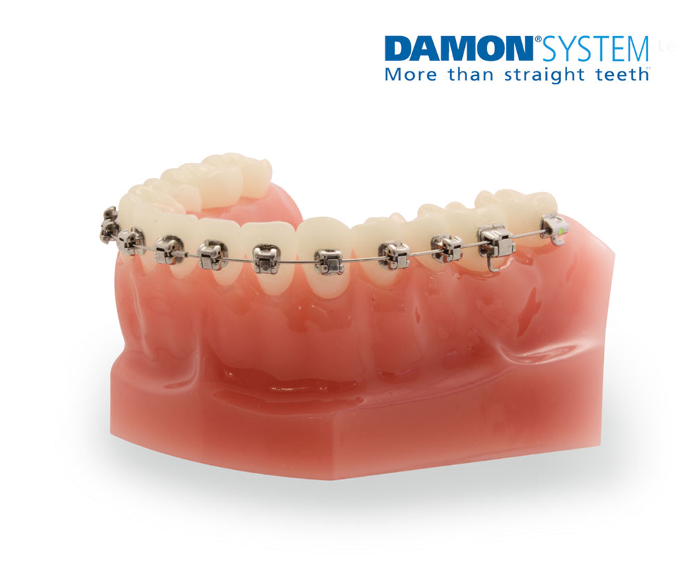 Fachzahnärzte für Kieferorthopädie Moers